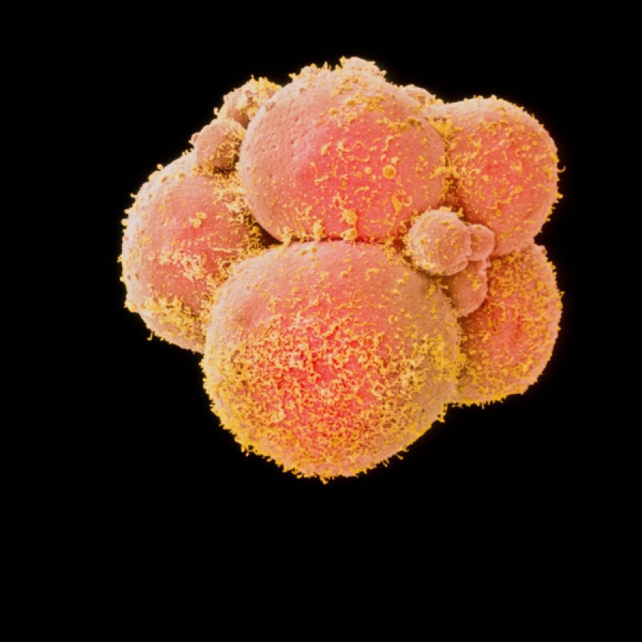 Human Embryo Cell
